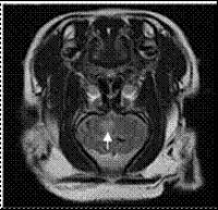 An embolic agent in the rete mirabile induces ischemic stroke in ...