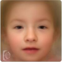 New rare disease with own facial features, cardiac defects and ...