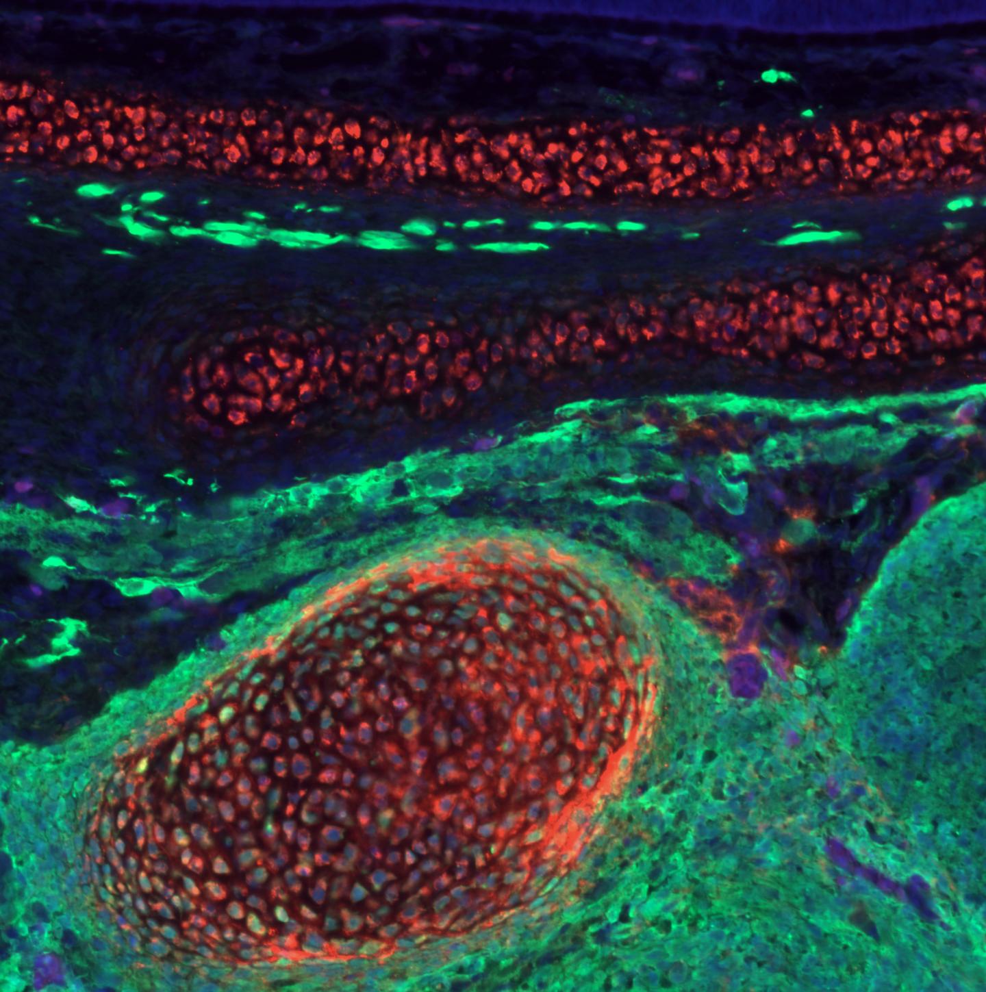 Repurposing Neural Crest Cells (3 of 6) | EurekAlert!