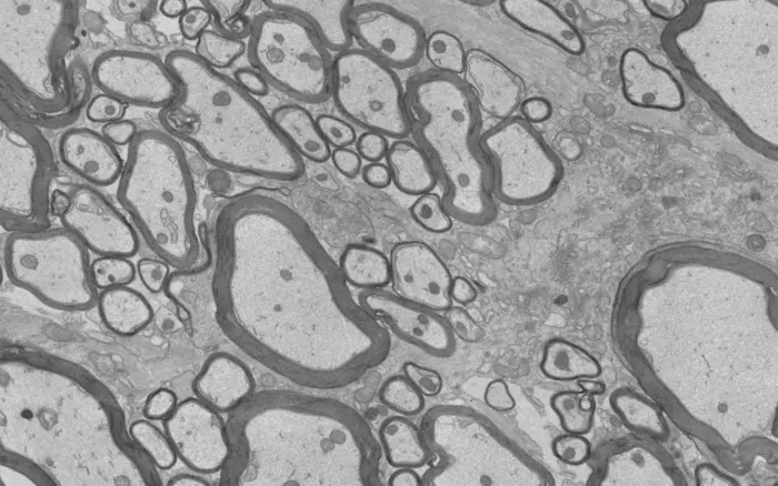 Researchers identify new ways to boost nervous system repair in MS ...