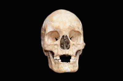 A Look at Leprosy over the Years (3 of 9) | EurekAlert!
