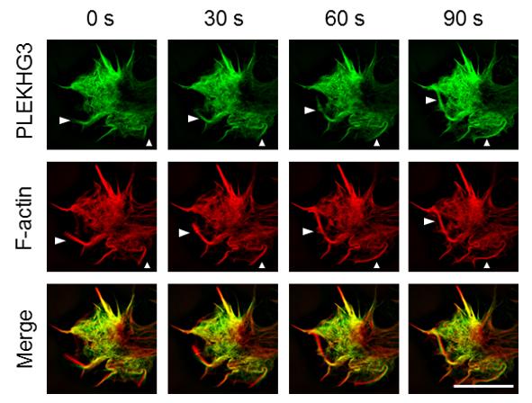 PLEKHFG3 and Actin Colocalize in Fibroblasts [IMAGE] | EurekAlert ...