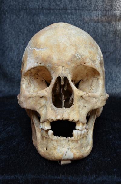 A Look at Leprosy over the Years (4 of 9) | EurekAlert!
