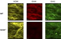 Understanding the role of IKACh in cardiac function | EurekAlert!