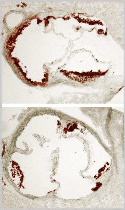 Mouse Arteries With and Without Fatty Acid Synthase [IMAGE ...