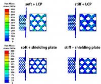 Soft Titanium Scaffolds Help Heal Large Bone Defects (1 of 3) | EurekAlert!