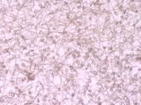 Impact of climate change on parasite infections depends on host ...