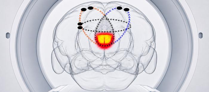 Towards deep brain stimulation without surgery | EurekAlert!