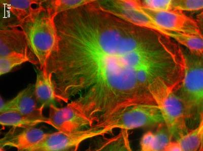 Giant Cells [IMAGE] | EurekAlert! Science News Releases