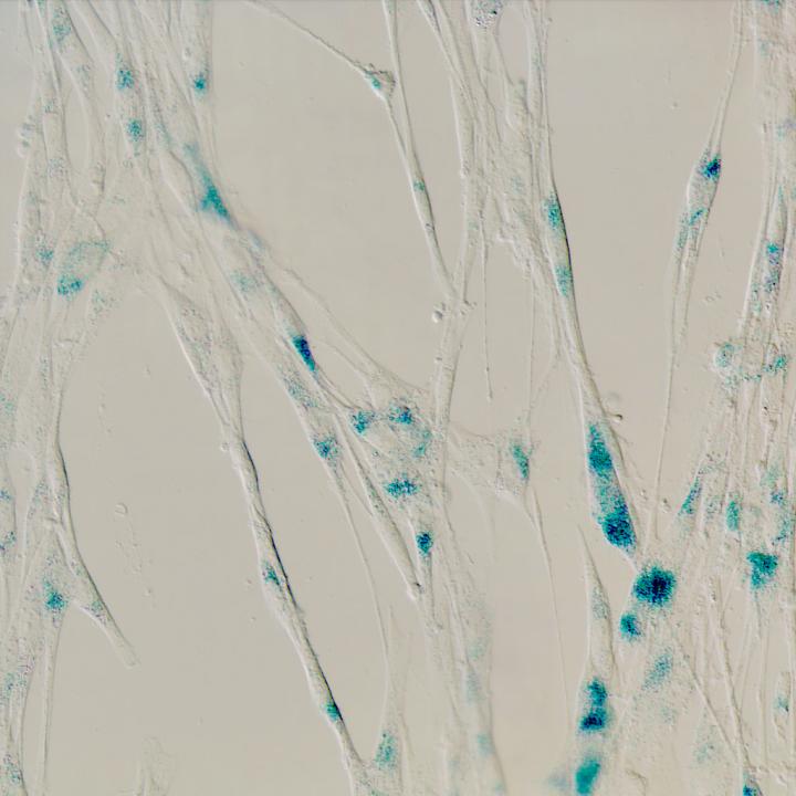 Senescent Cells [IMAGE] | EurekAlert! Science News Releases