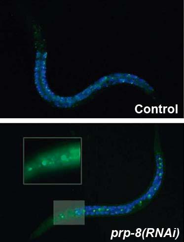 Researchers create a worm model to investigate a rare subtype of ...