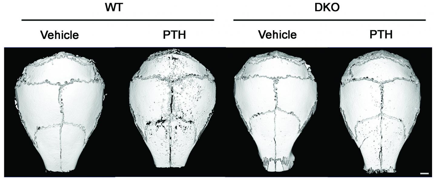 Hampering Bone Breakdown Protects Bone Health in Mice (5 of 6) [IMAGE ...