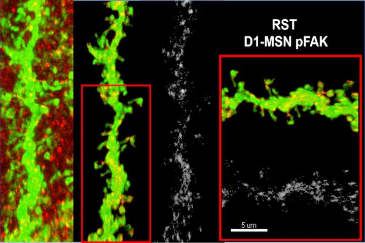 Enlarged Dendrites after Drug Reinstatement [IMAGE] | EurekAlert ...