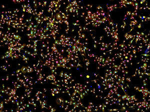 New bacterial therapy approach to treat lung cancer | EurekAlert!