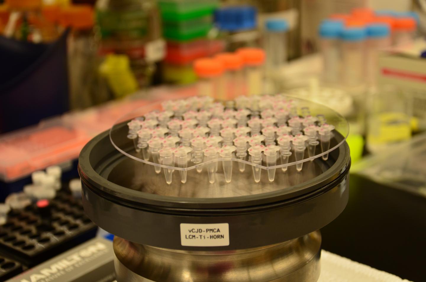 Blood Test for Prion Disease Could Make Blood Supply Safer | EurekAlert!