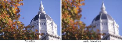 Normal and Cataract Vision [IMAGE] | EurekAlert! Science News Releases