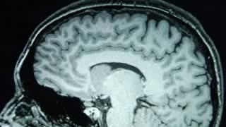 The Connection Between Memory and Sleep | EurekAlert!