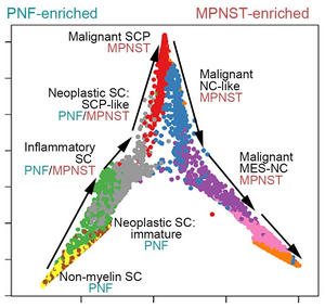 Druggable targets found for treating rare, deadly nerve cancer MPNST ...