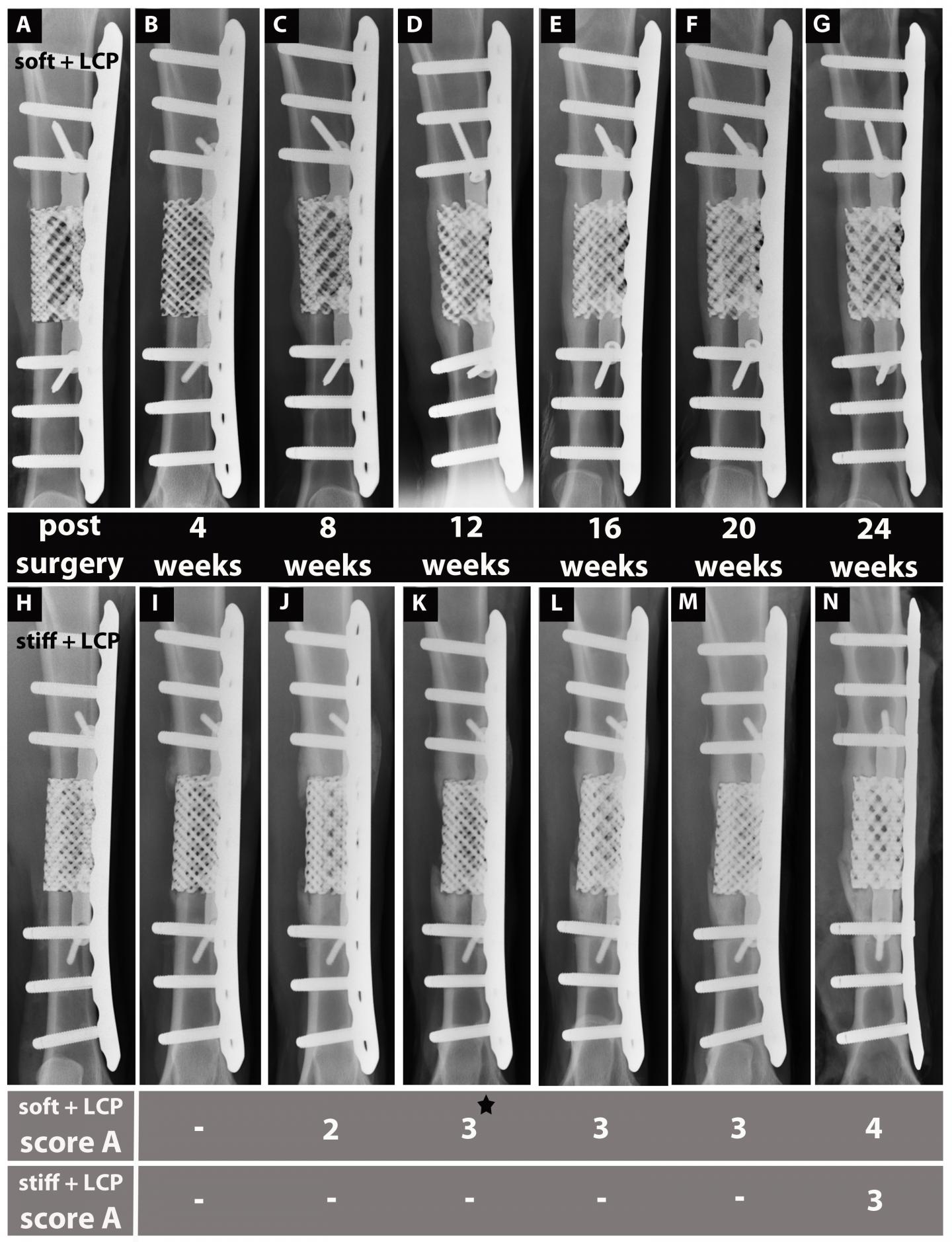 Soft Titanium Scaffolds Help Heal Large Bone Defects (2 of 3) [IMAGE ...