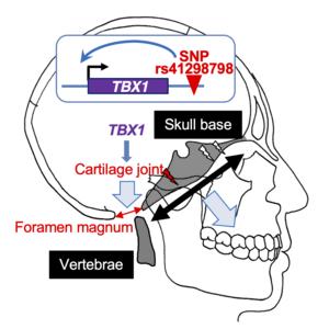Genetic variant identified that shaped the human skull base | EurekAlert!
