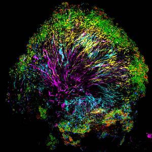 The road to better health requires a map of the microbes in your mouth ...
