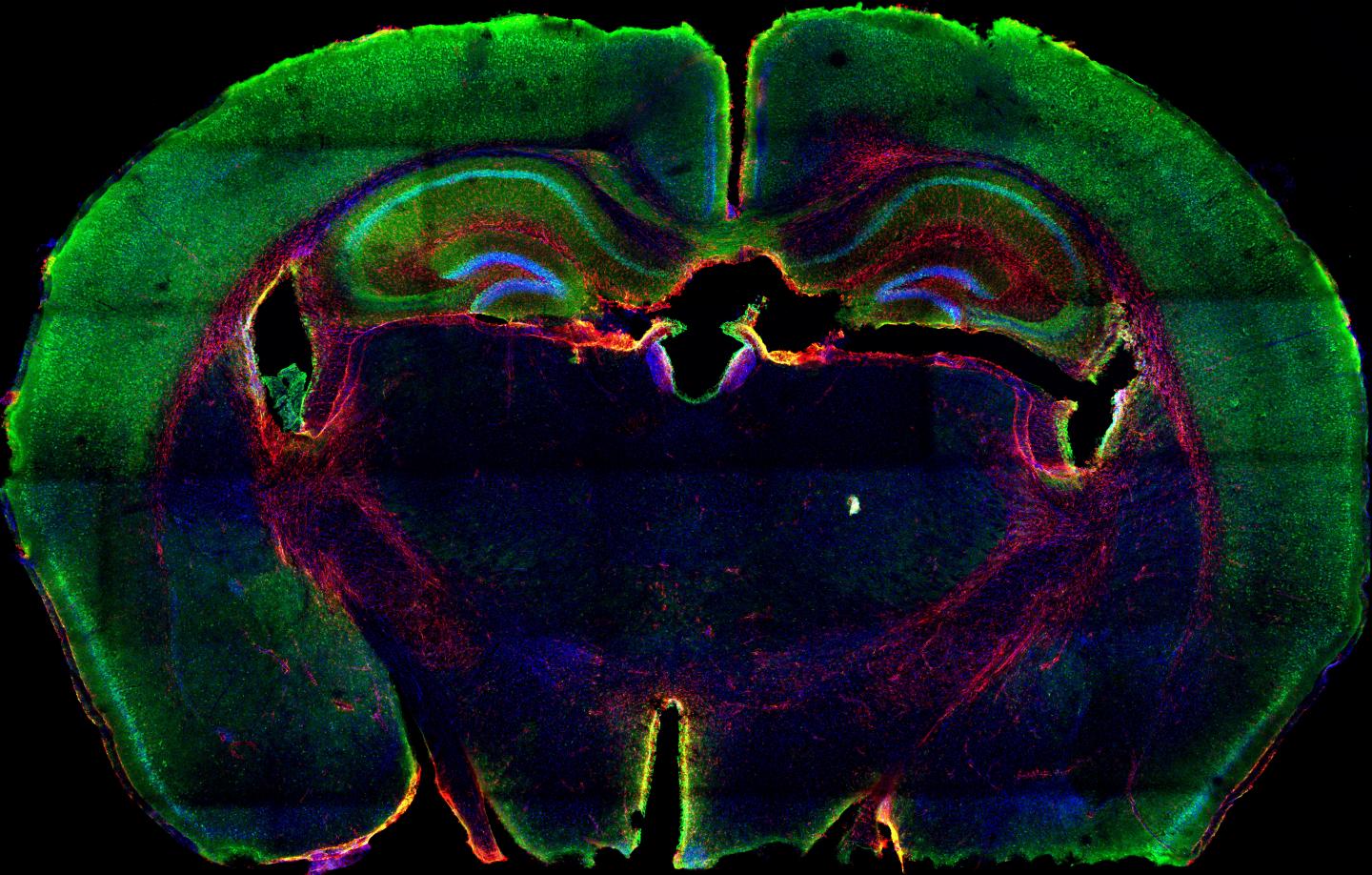 New Glioma Mouse Model [IMAGE] | EurekAlert! Science News Releases