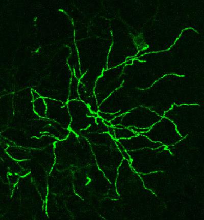 Thalamic Neuron [IMAGE] | EurekAlert! Science News Releases