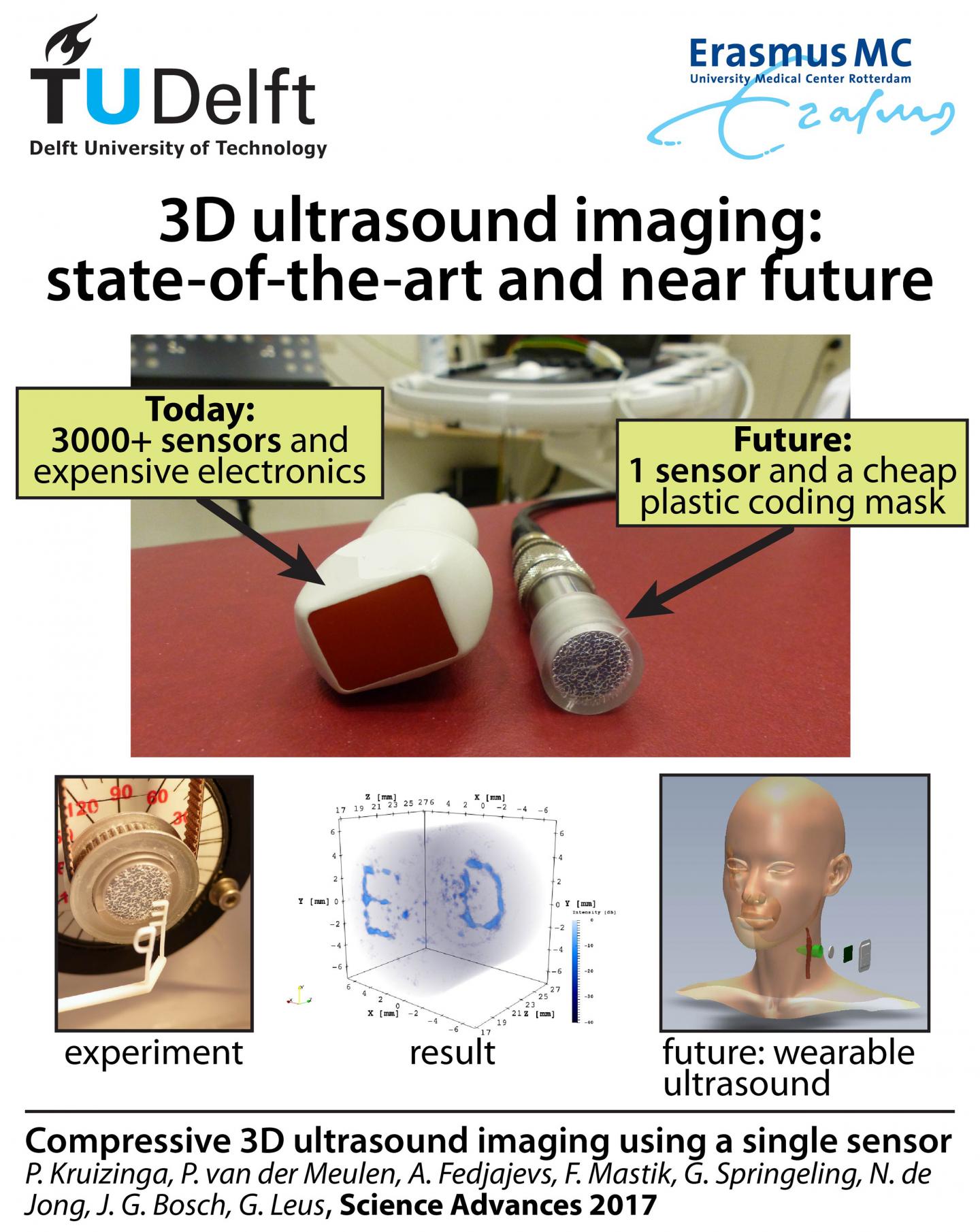 One Sensor, Instead of Thousands, for 3-D Ultrasound Imaging (2 of 2 ...