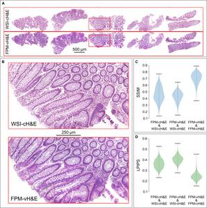 AI transforms microscopy, enabling diagnostic-quality "virtual staining ...