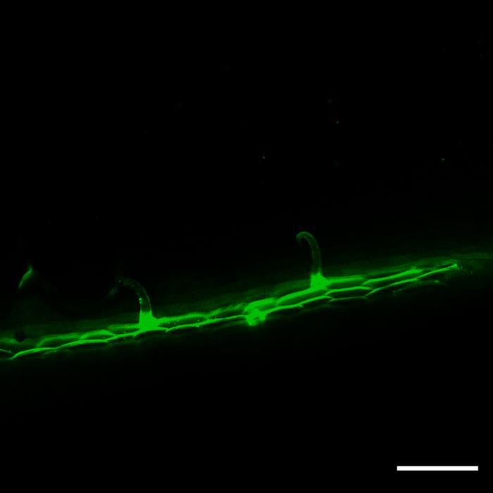 Hooked hairs 3 [IMAGE] | EurekAlert! Science News Releases